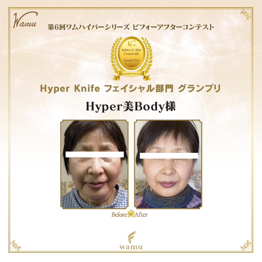 ミニモとホットペッパービューティーのどっちを掲載するべき？ ワムタイムズ